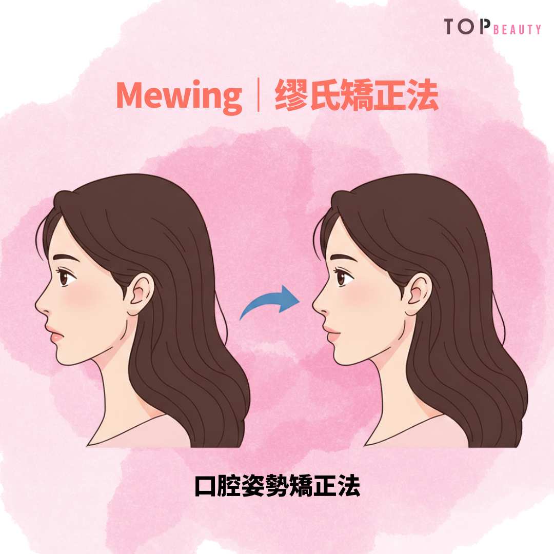 Mewing教學懶人包｜瘦面/消雙下巴方法+正確做法+效果+風險解析